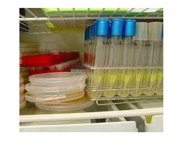 Microbial Culture Preservation and its Methods | PPTX