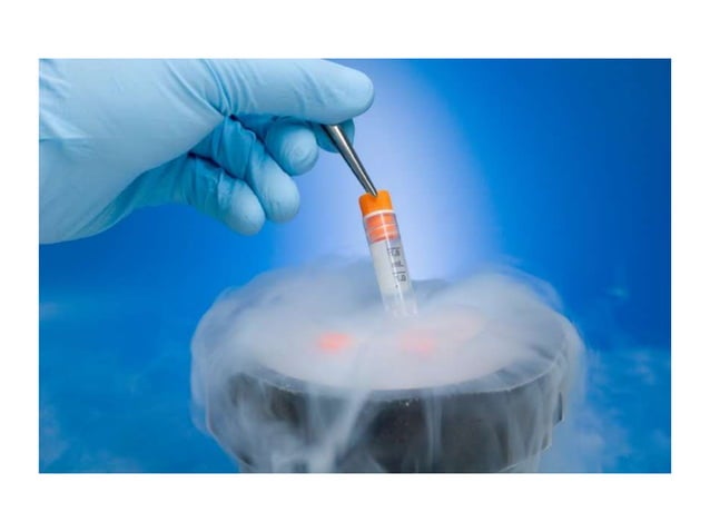 Microbial Culture Preservation and its Methods | PPT