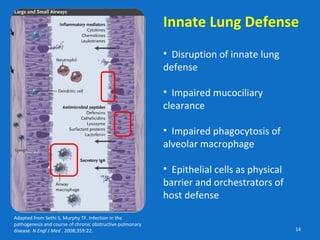 When to Use Antibiotics for an Acute Exacerbation of COPD | PPT