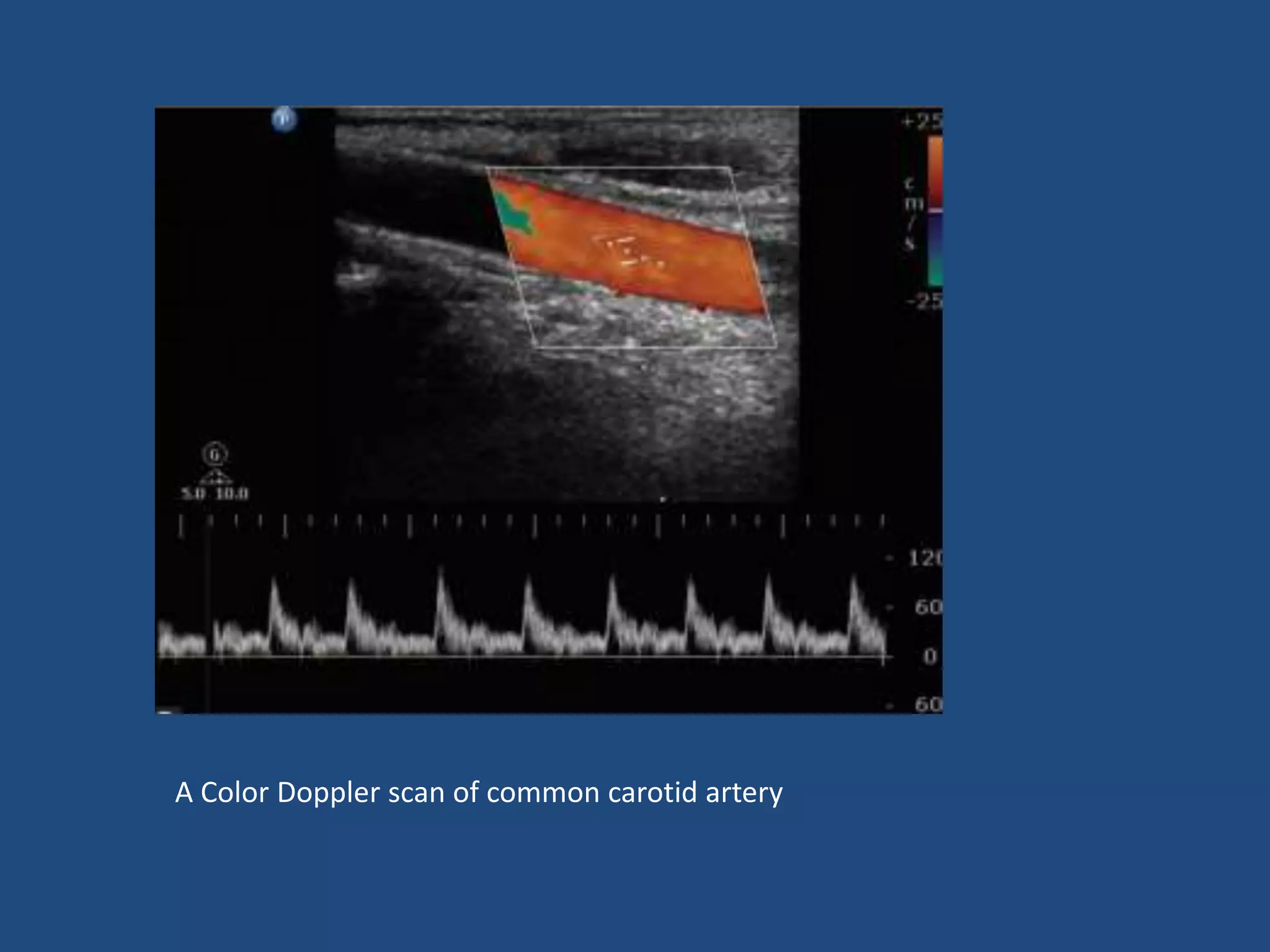 ADVANCED IMAGING MODALITIES IN ORAL & MAXILLOFACIAL BY DR. ADHIRAJ ...