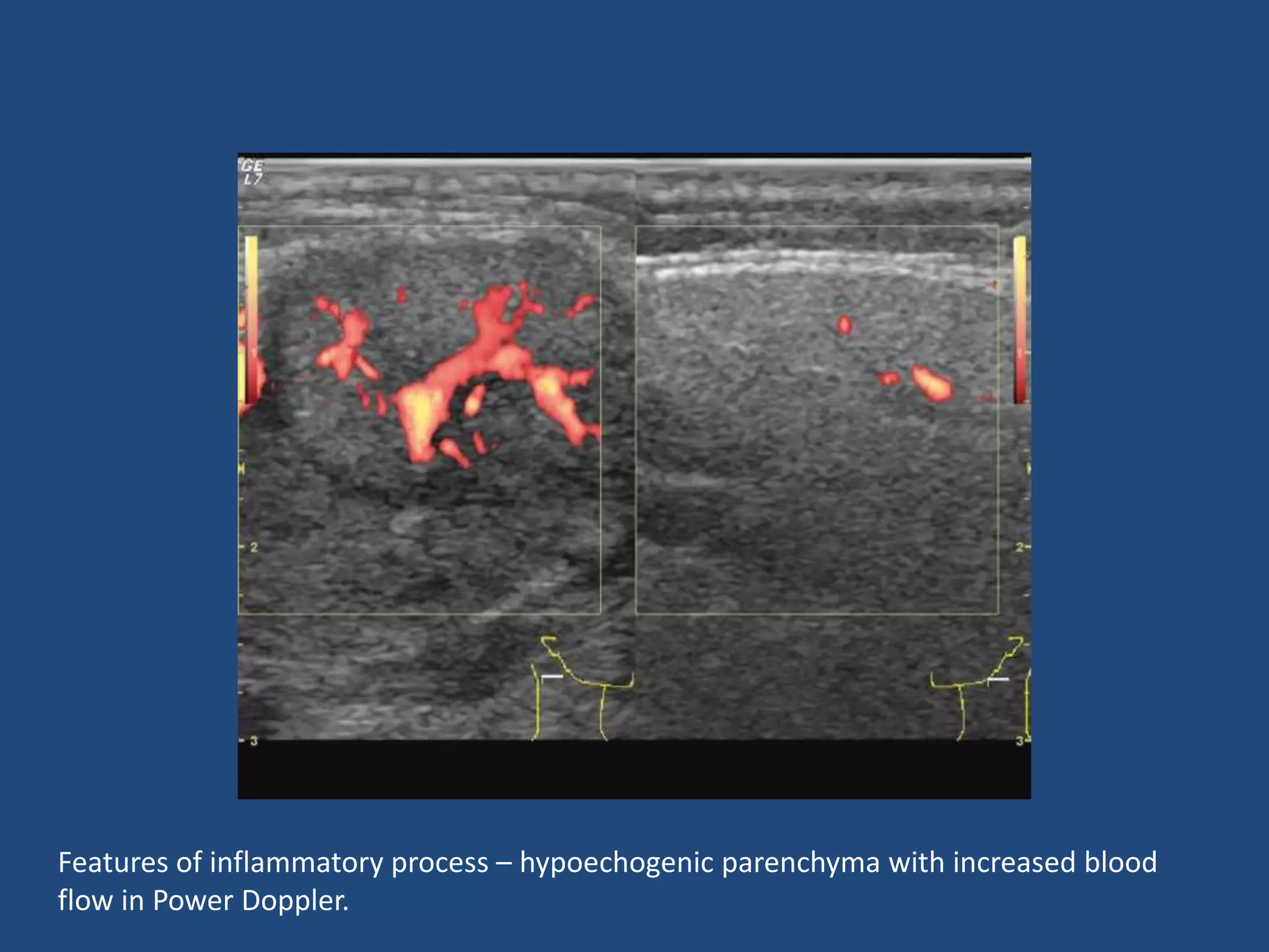 ADVANCED IMAGING MODALITIES IN ORAL & MAXILLOFACIAL BY DR. ADHIRAJ ...