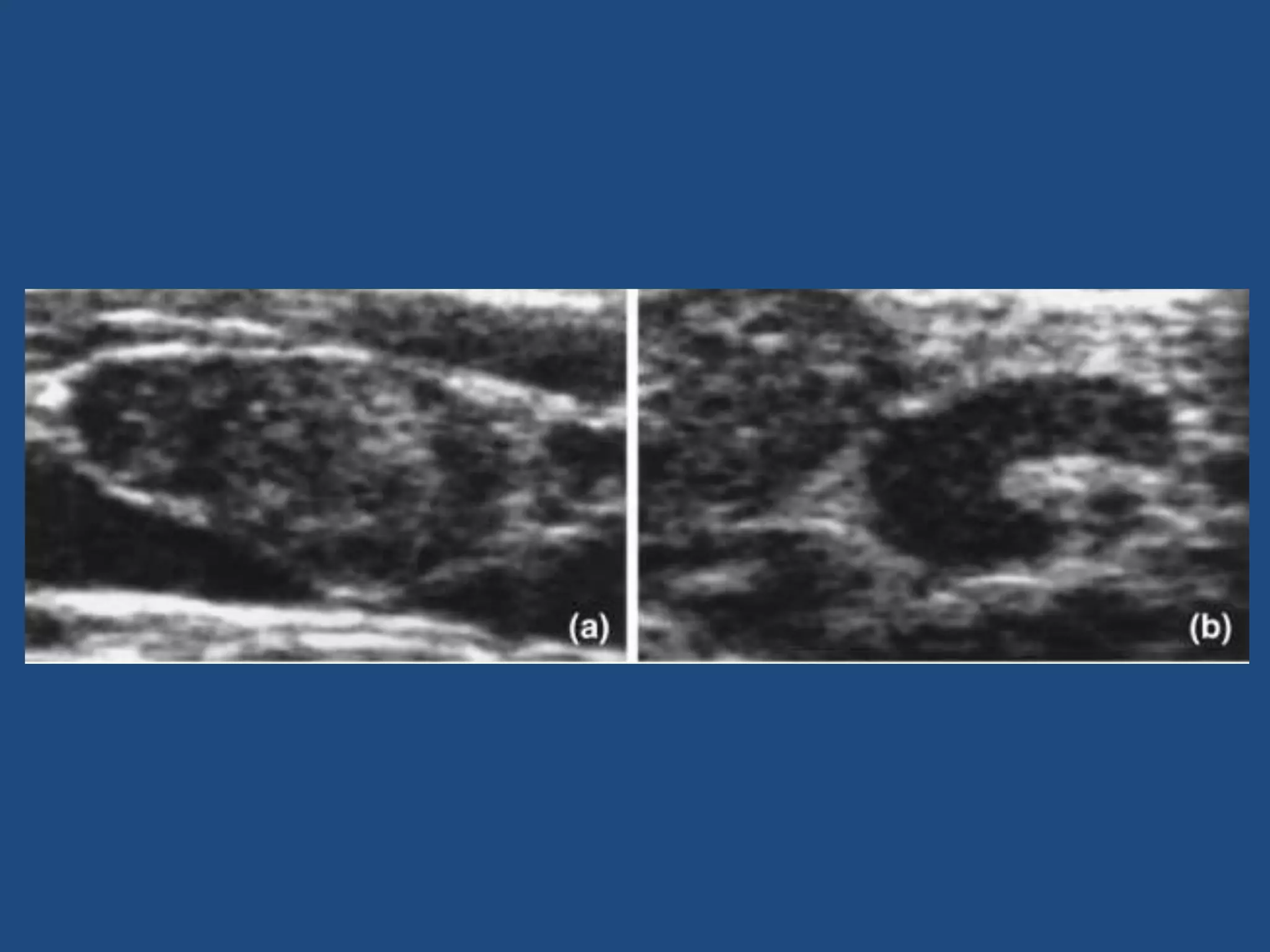 ADVANCED IMAGING MODALITIES IN ORAL & MAXILLOFACIAL BY DR. ADHIRAJ ...