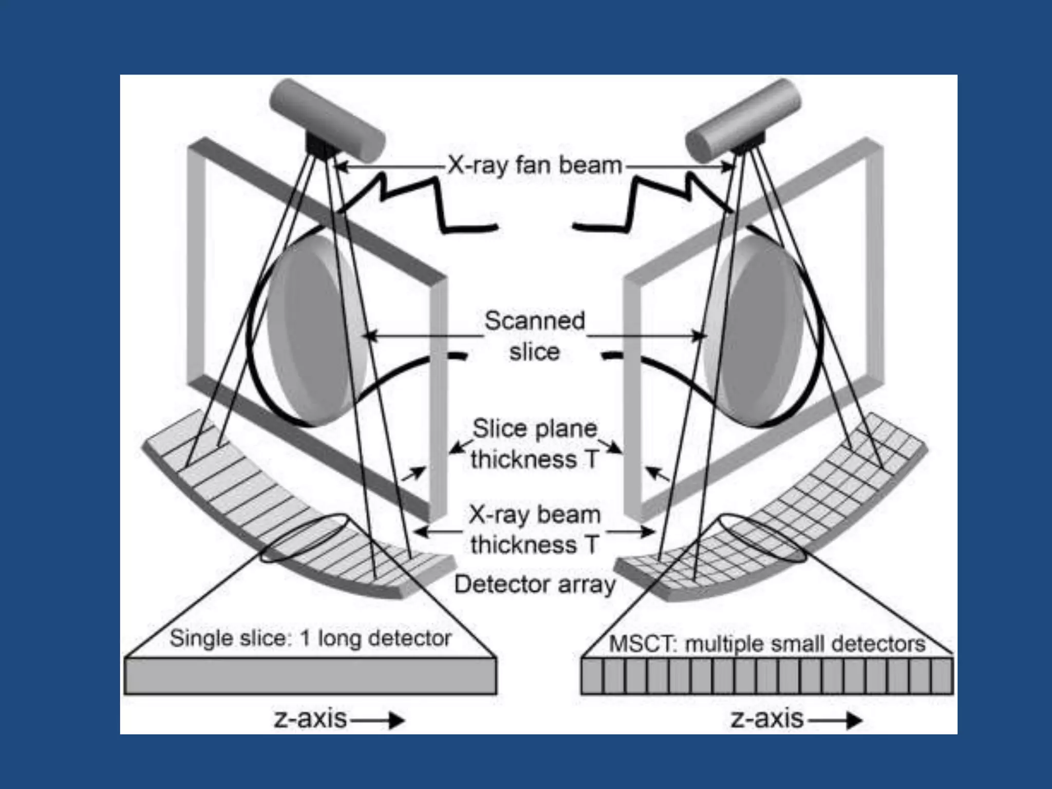 ADVANCED IMAGING MODALITIES IN ORAL & MAXILLOFACIAL BY DR. ADHIRAJ ...