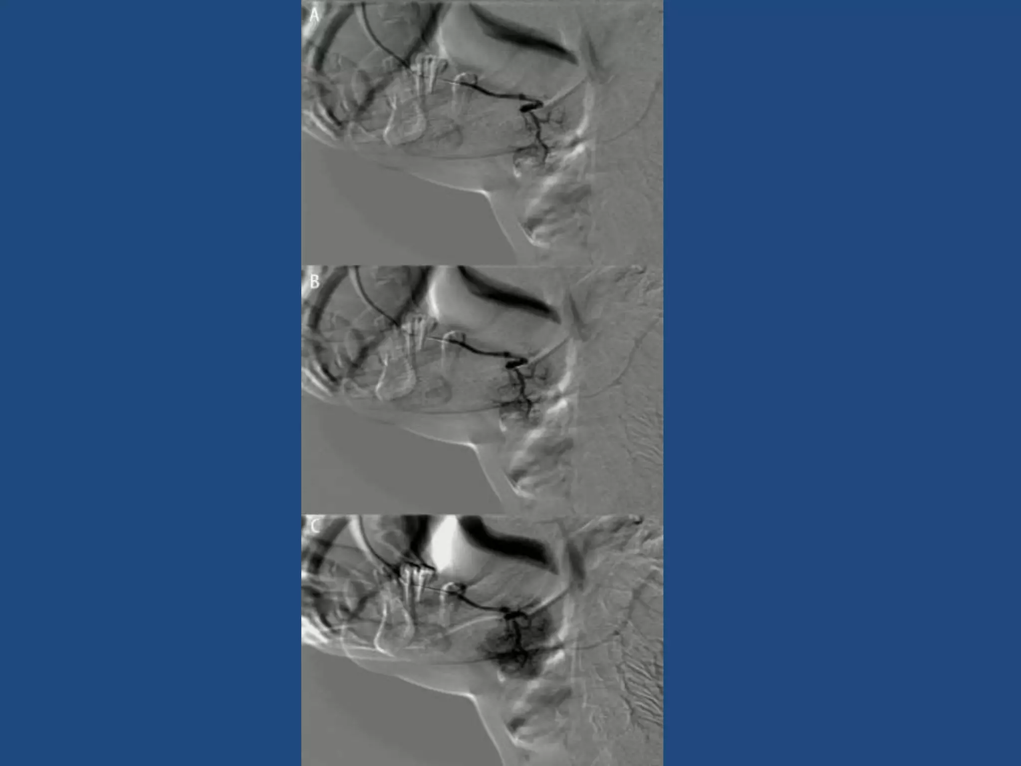 ADVANCED IMAGING MODALITIES IN ORAL & MAXILLOFACIAL BY DR. ADHIRAJ ...