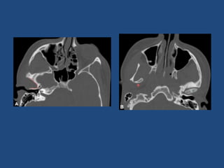 ADVANCED IMAGING MODALITIES IN ORAL & MAXILLOFACIAL BY DR. ADHIRAJ ...