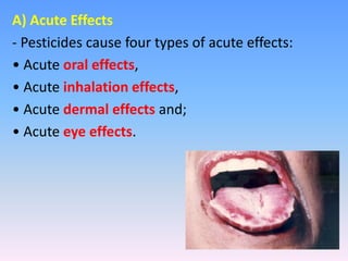 Pesticids and Health hazards | PPTX