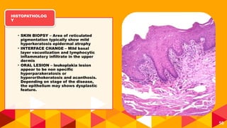 ORAL POTENTIALLY MALIGNANT DISORDERS (OPMD) | PPTX