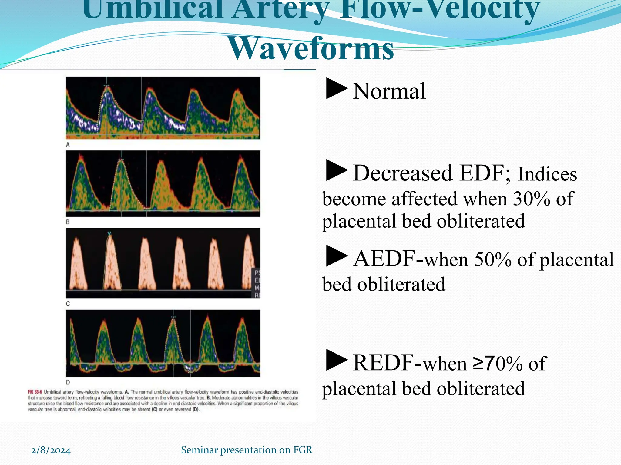 Seminar Presentation on fetal growth restriction | PPTX
