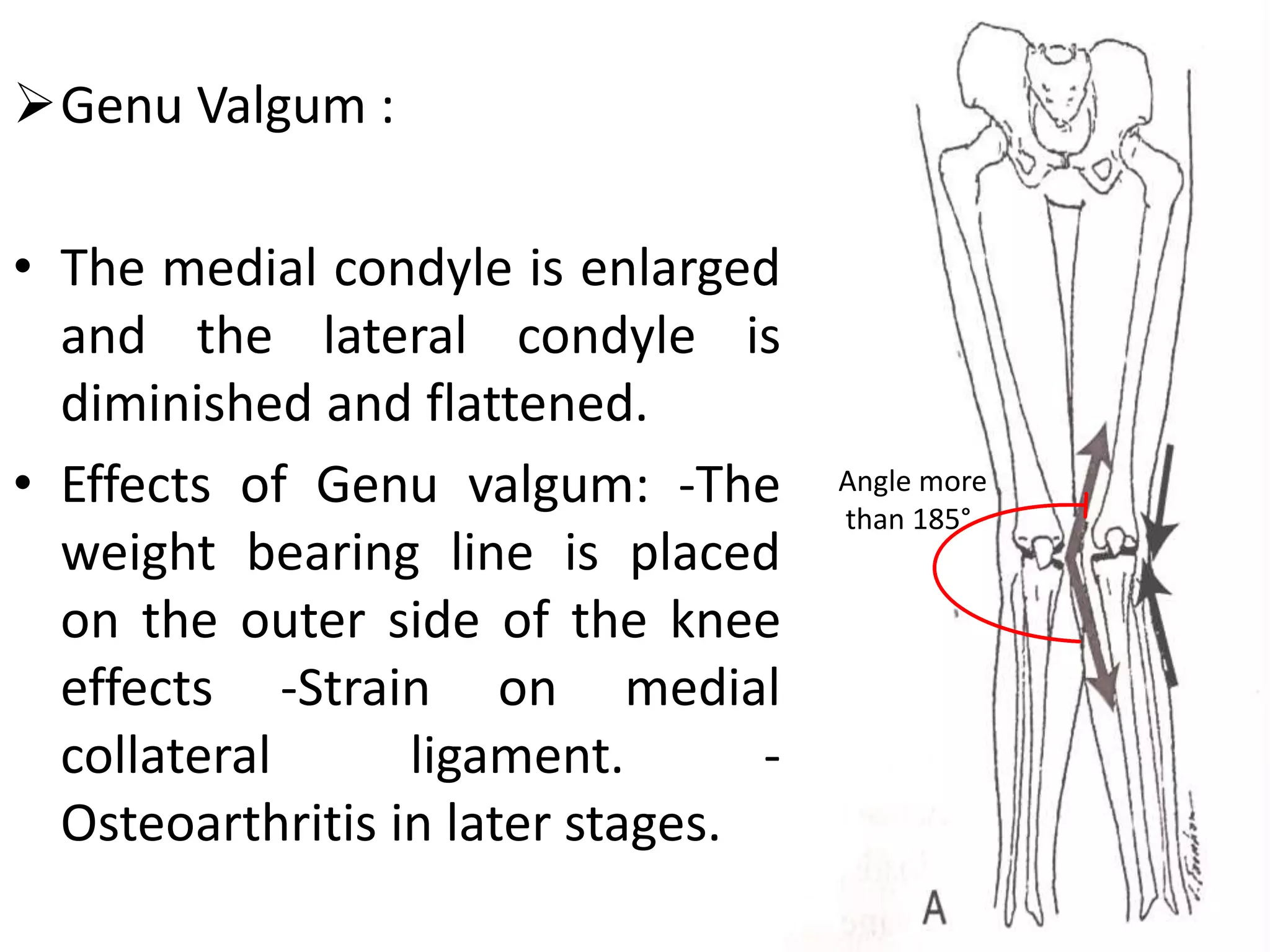 Pathomechanics Knee.pptx