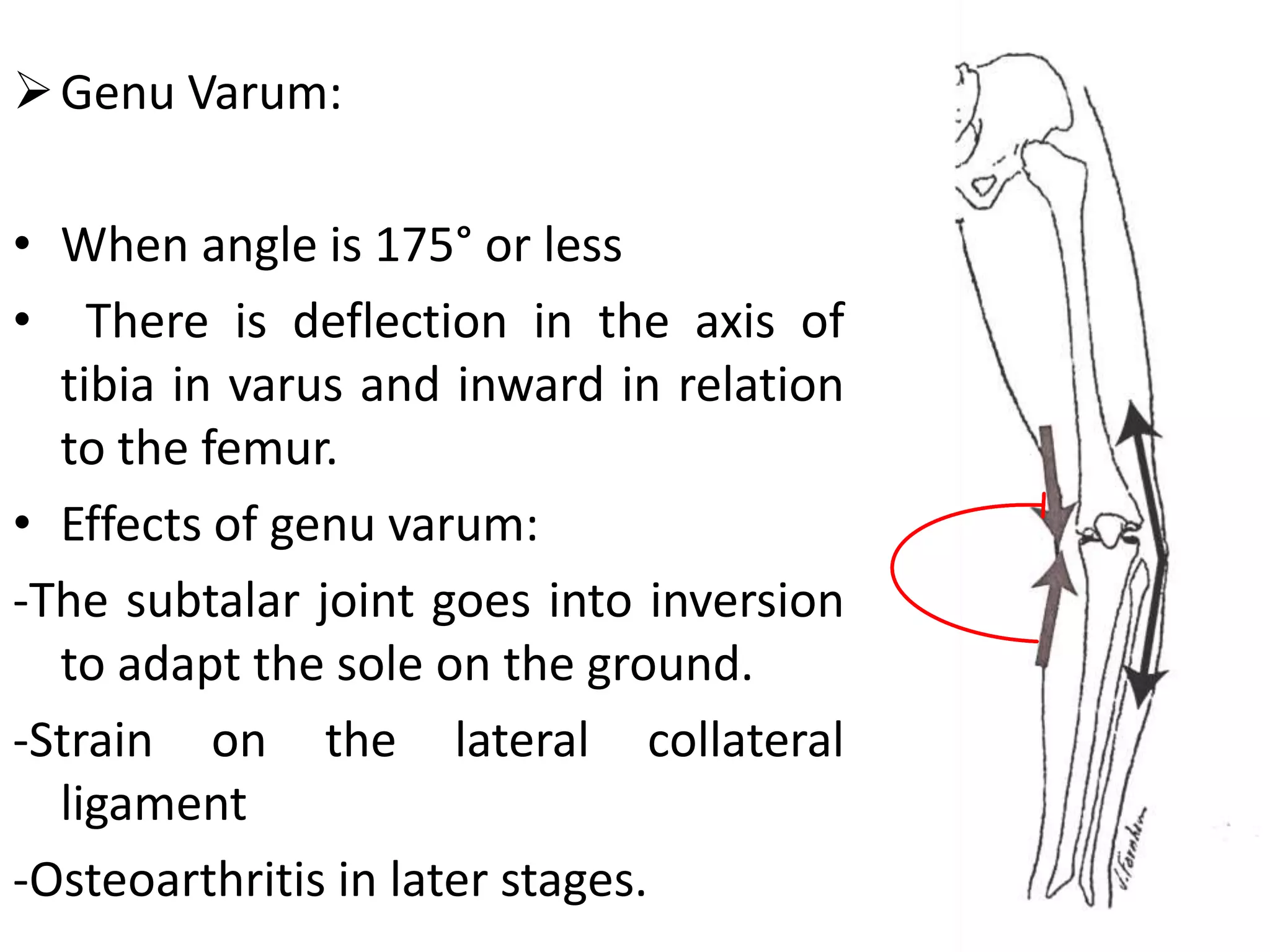 Pathomechanics Knee.pptx
