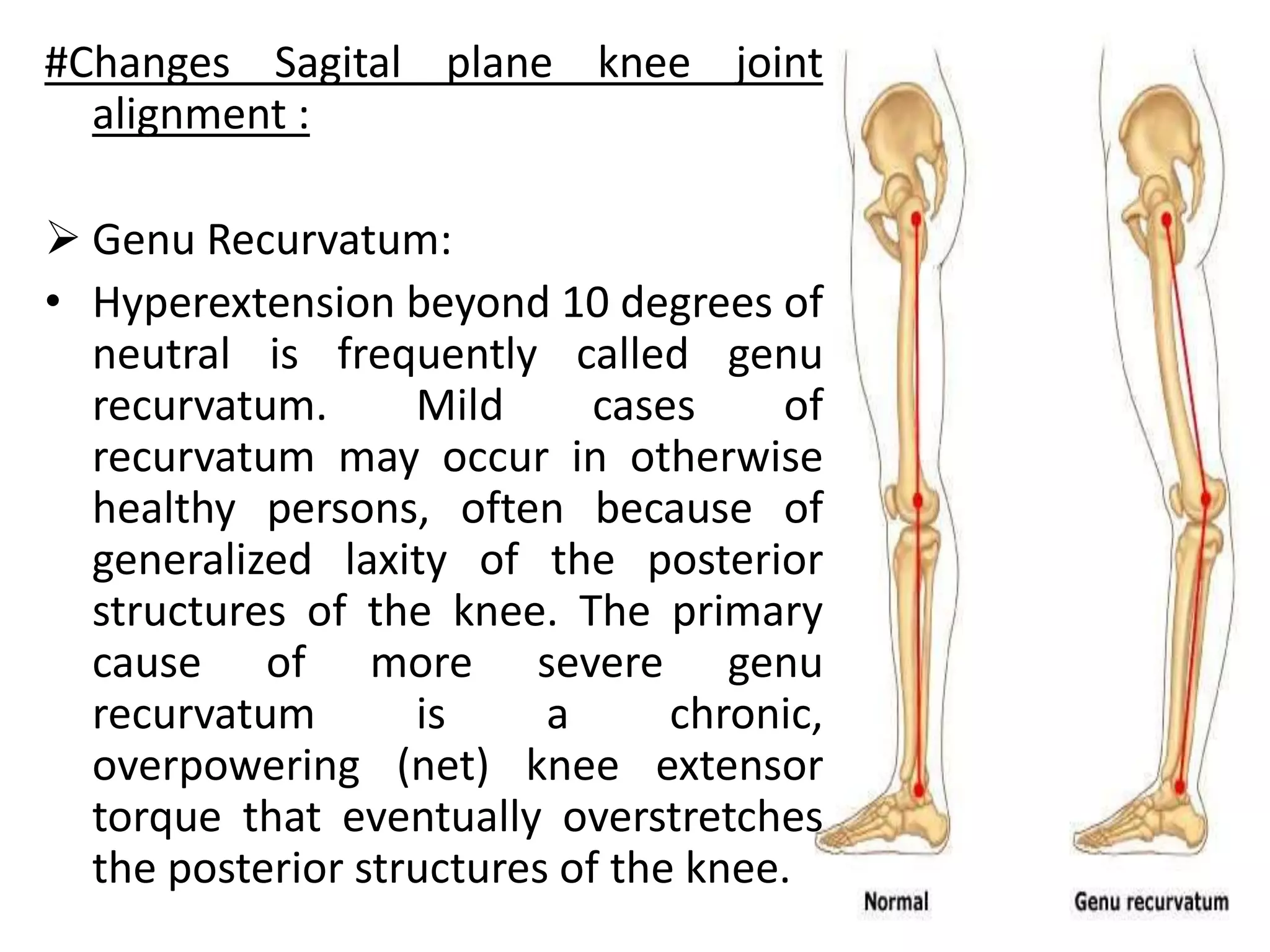 Pathomechanics Knee.pptx