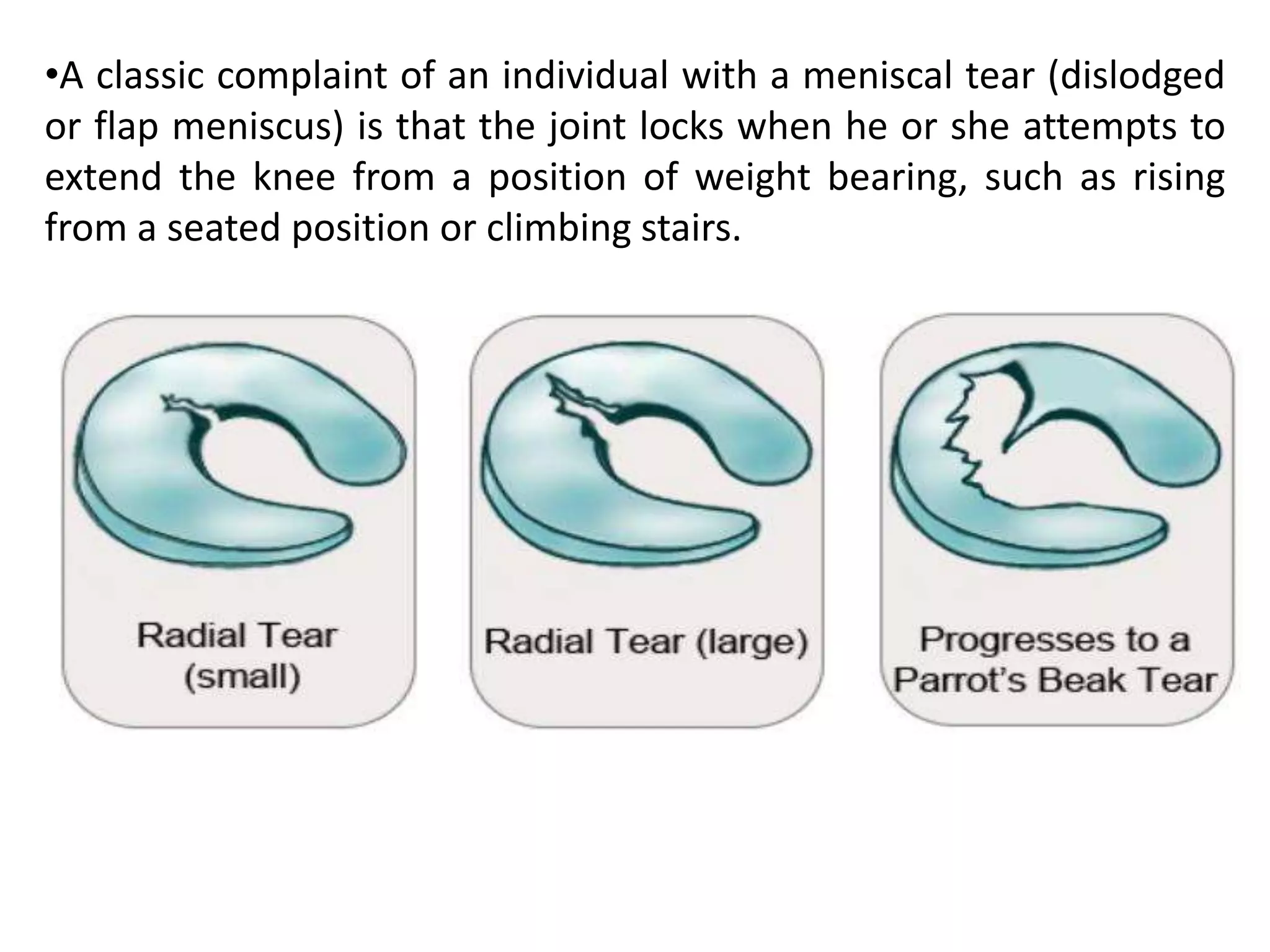 Pathomechanics Knee.pptx