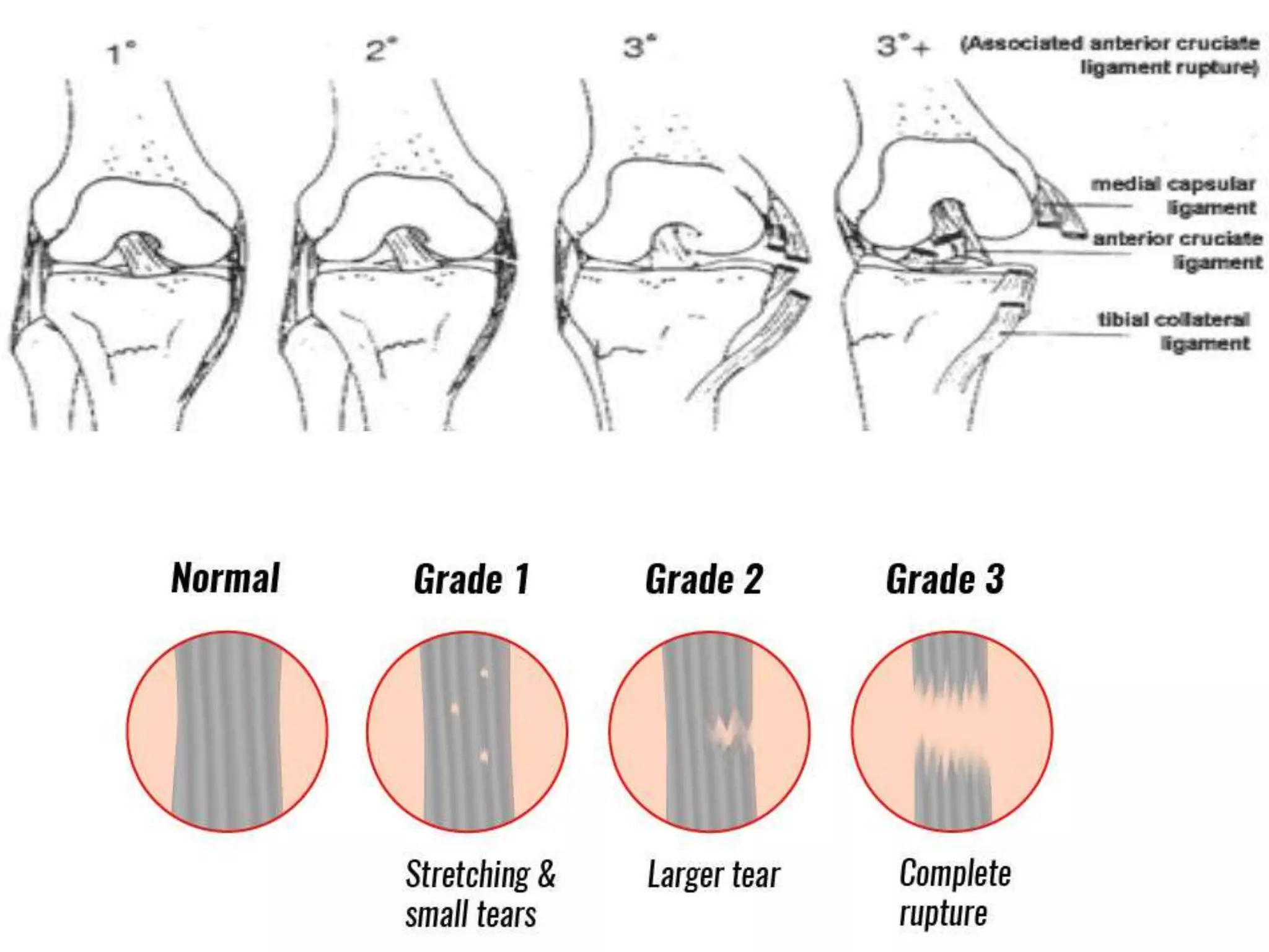 Pathomechanics Knee.pptx