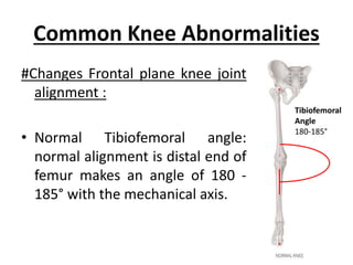 Pathomechanics Knee.pptx