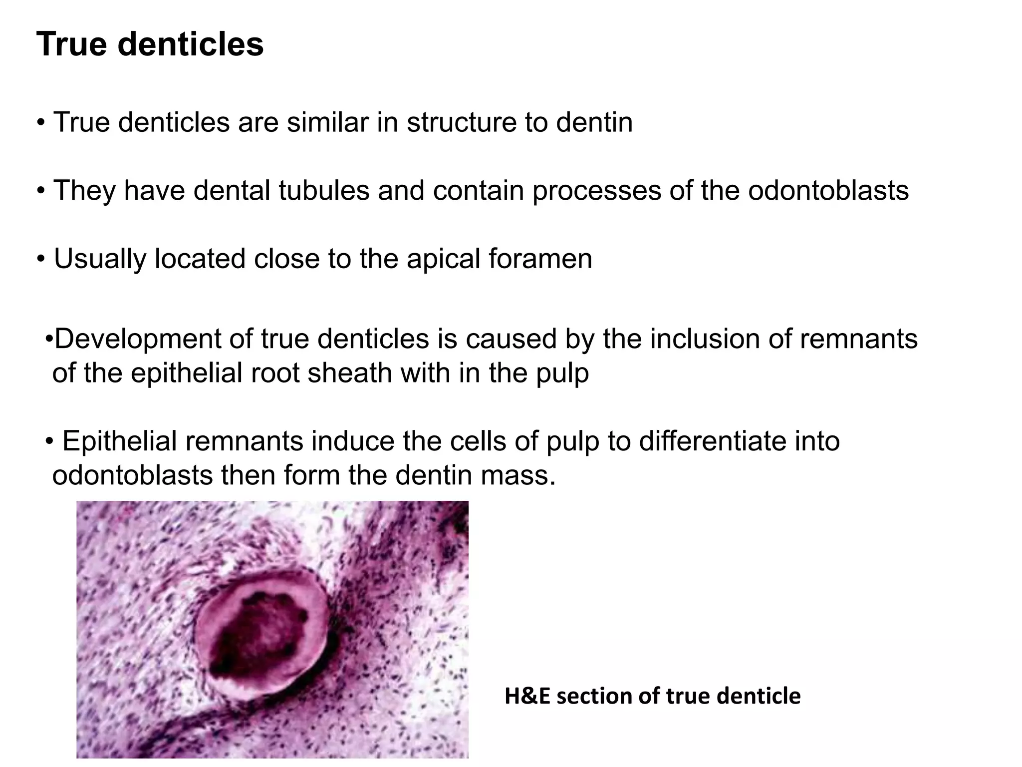 Pulp and cementum | PPTX