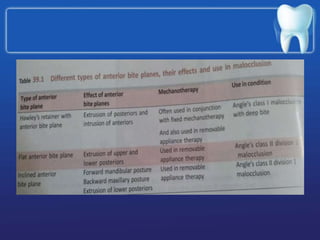 deep bite management | PPTX