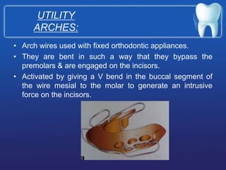 deep bite management | PPTX | Oral care | Personal Care