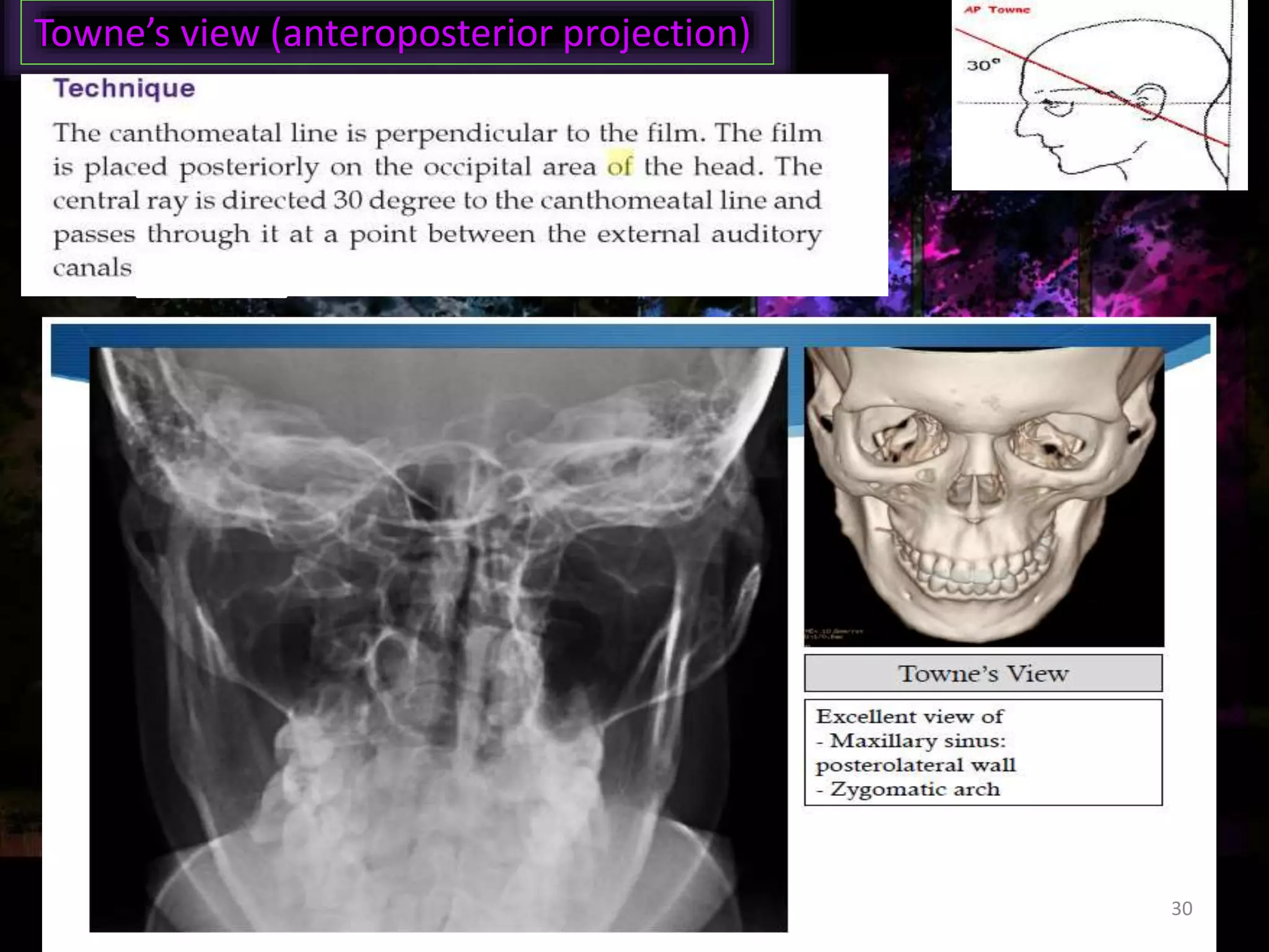 conventional radiography in maxillofacial trauma | PPTX