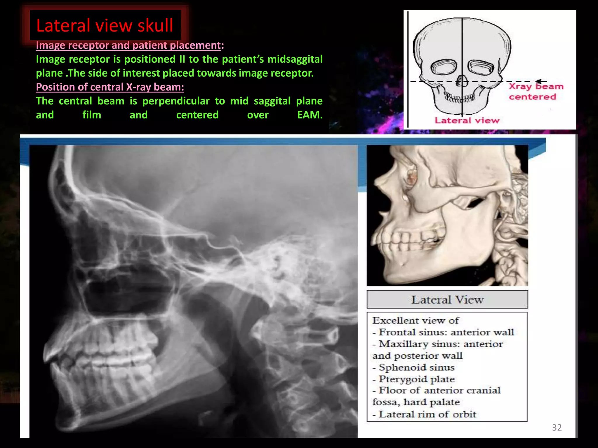conventional radiography in maxillofacial trauma | PPTX