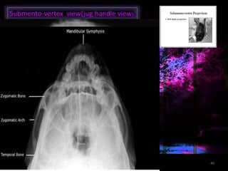conventional radiography in maxillofacial trauma | PPTX