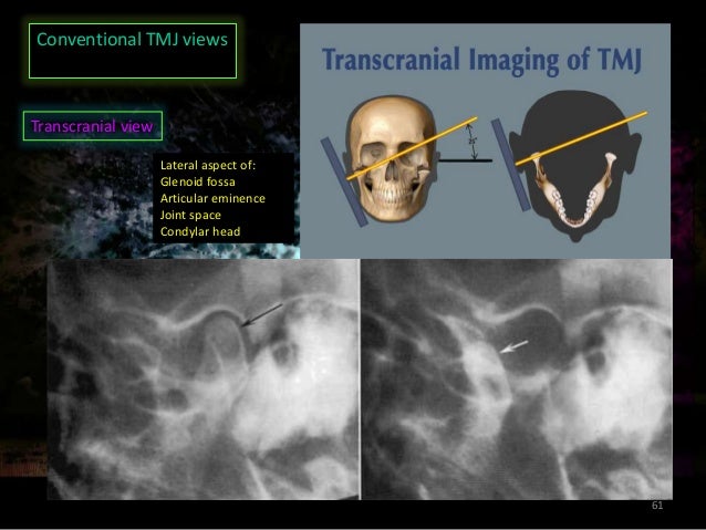 conventional radiography in maxillofacial trauma