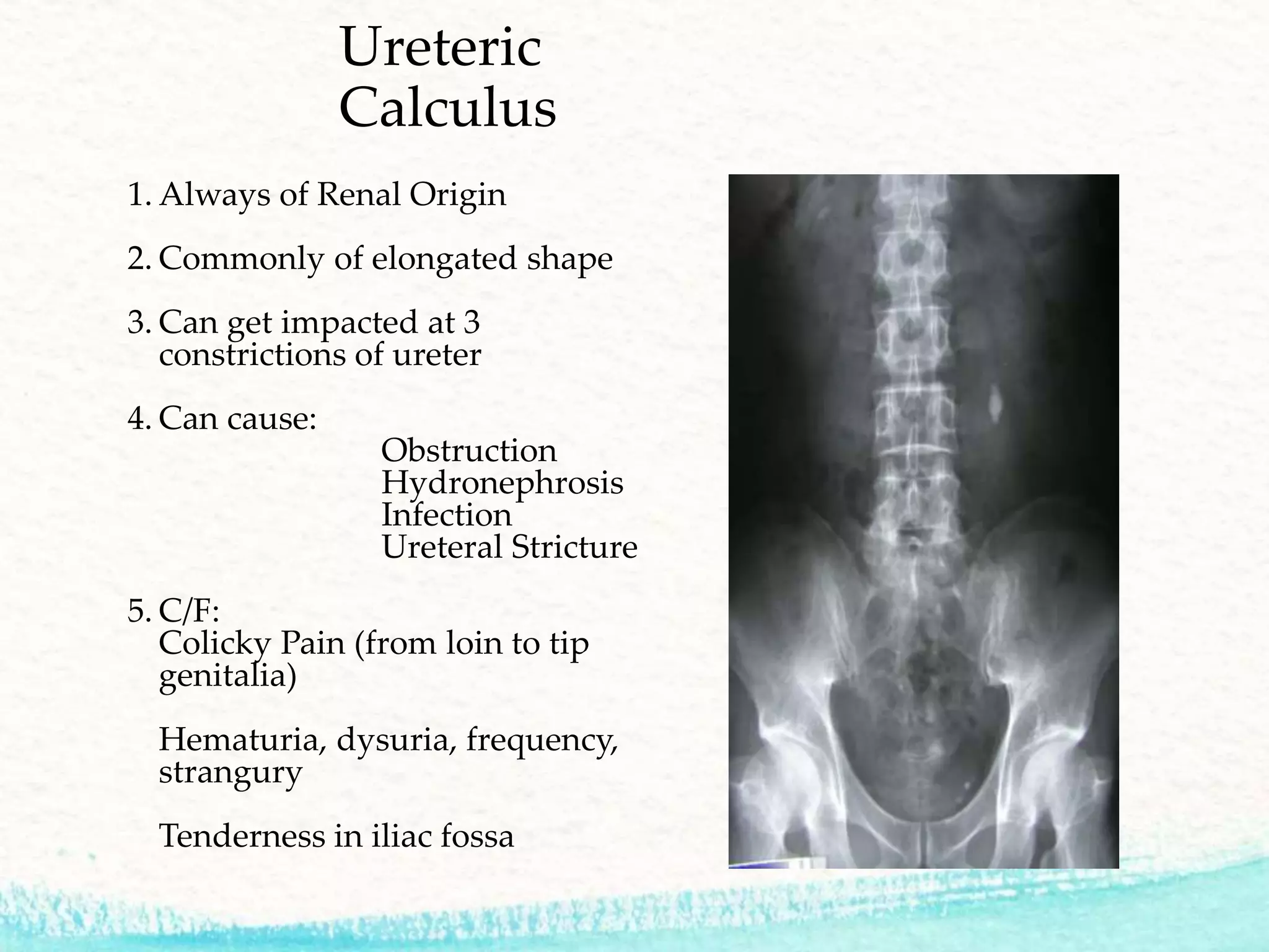 Seminar renal stone on 24.10.16