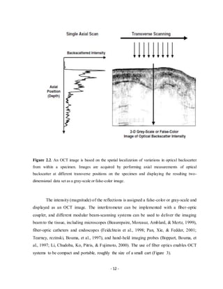 Optical Coherence Tomography: Technology and applications for ...
