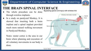 Seminar on reverse paralysis | PPT