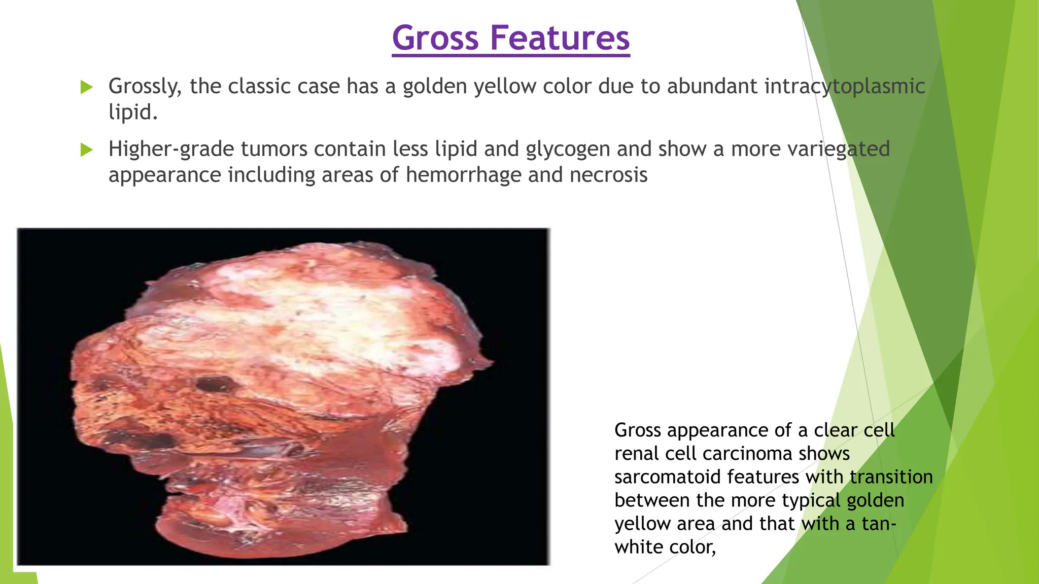 Seminar RKS kidney.pptxkidney slides- pathogenesis features of rcc | PPTX