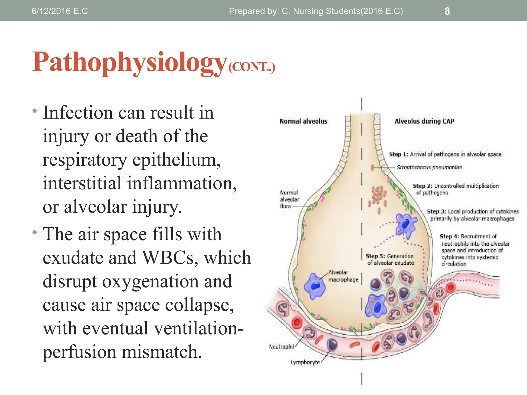 Pneumonia pathophysiology details ppt free | PPTX
