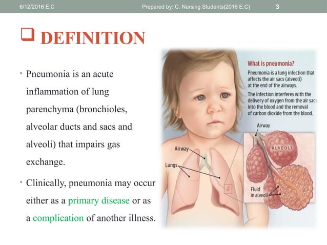 Pneumonia pathophysiology details ppt free | PPT
