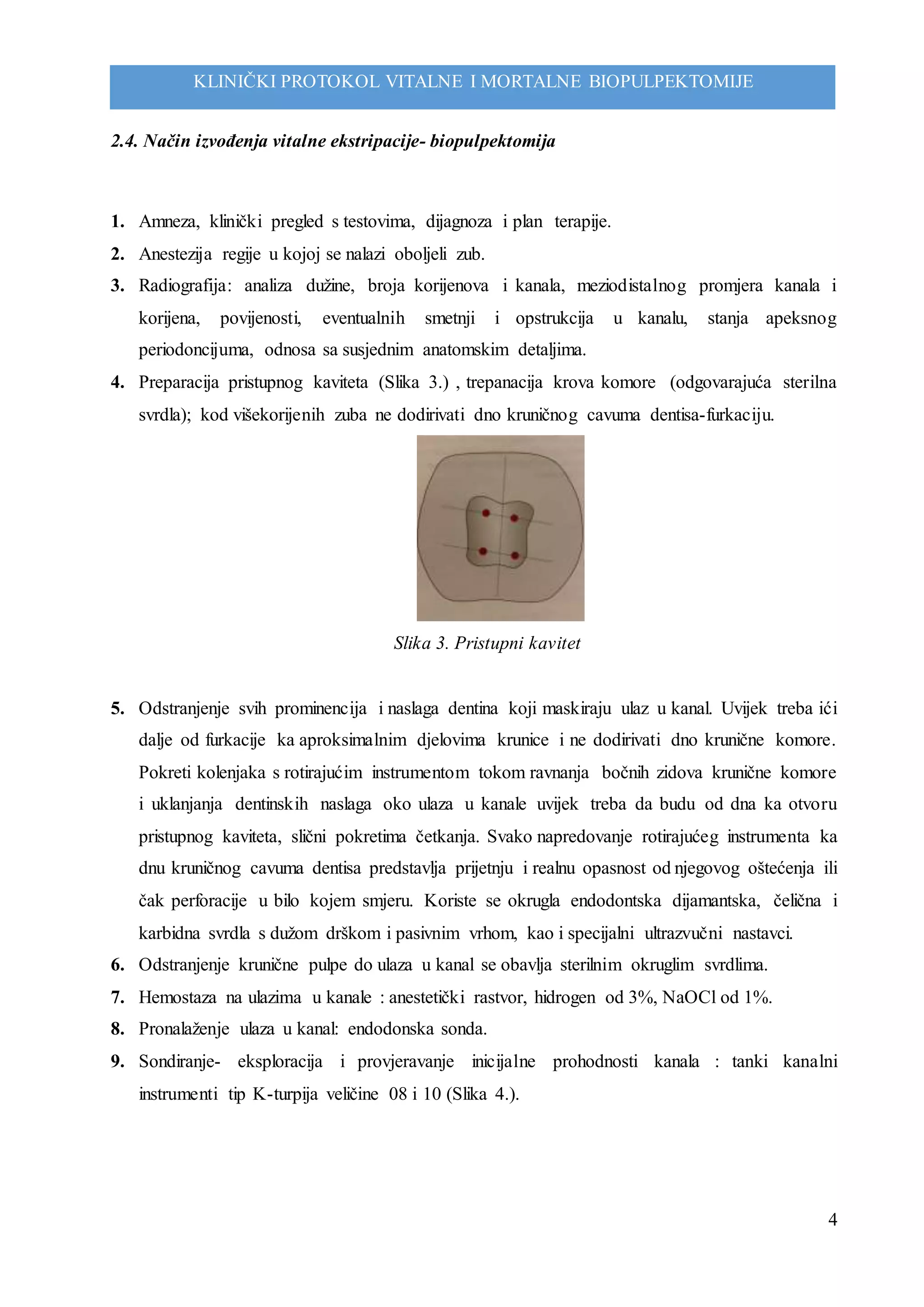 Seminarski rad Endodoncija.docx
