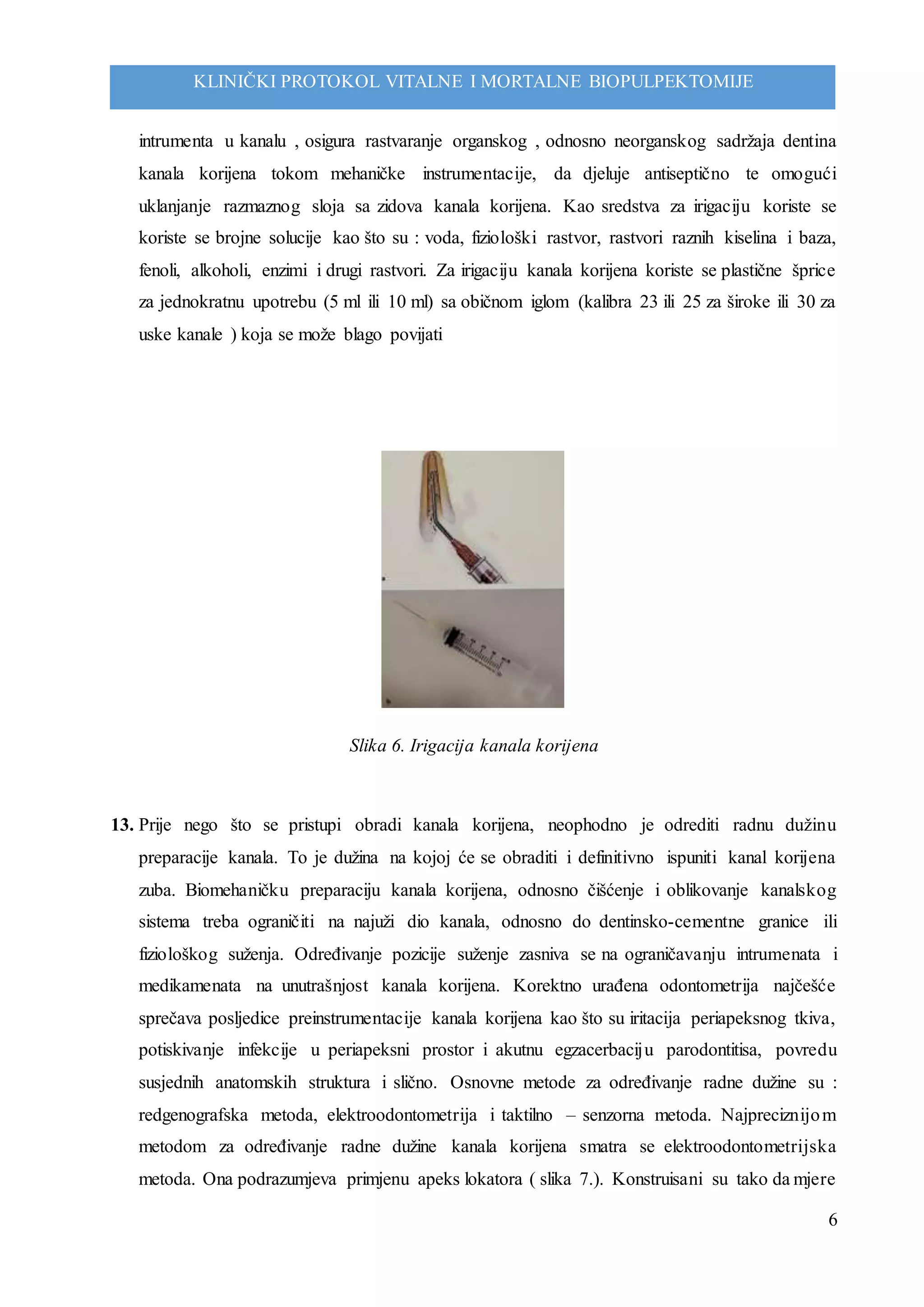 Seminarski rad Endodoncija.docx