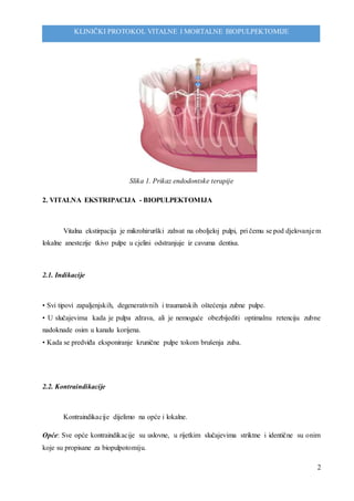 Seminarski rad Endodoncija.docx