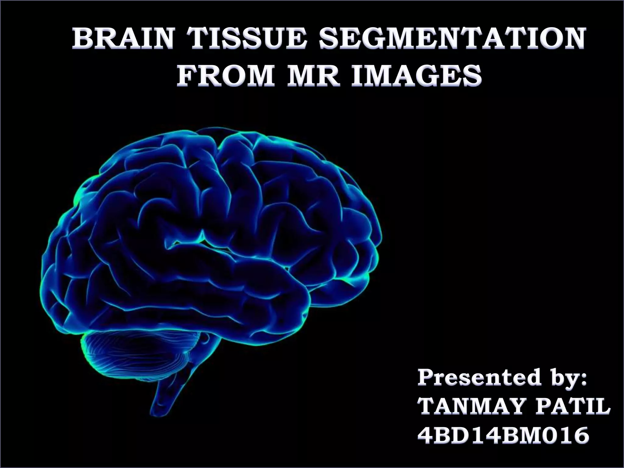 Brain tissue segmentation from MR images | PPT