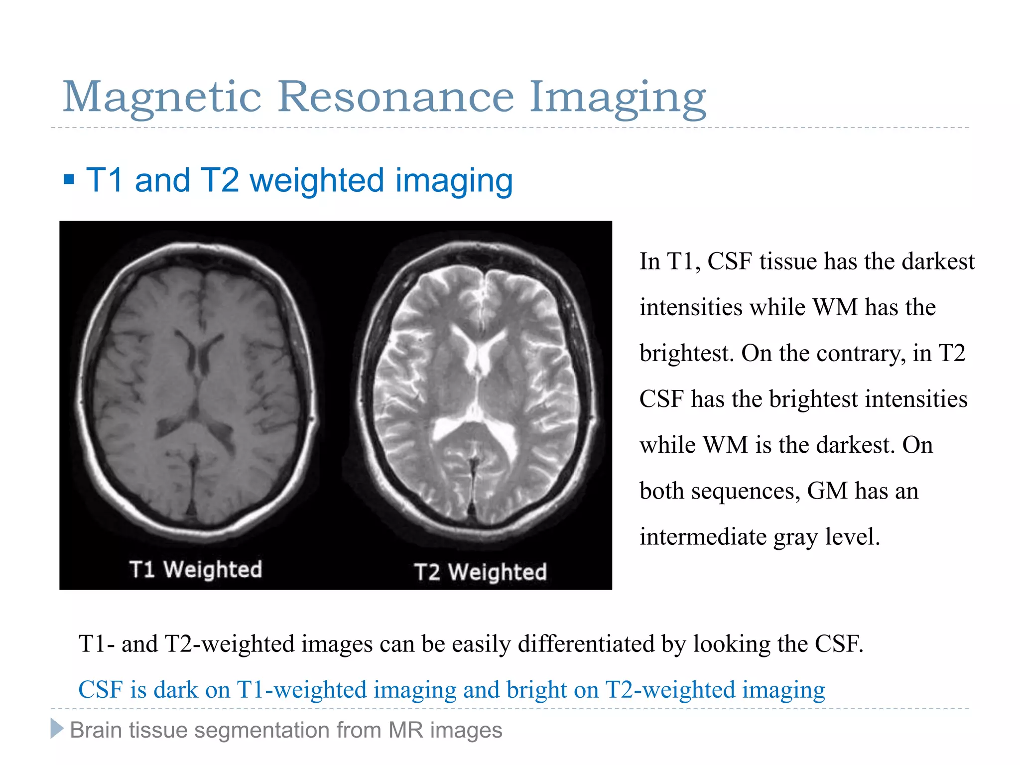 Brain Tissue Segmentation From Mr Images Ppt