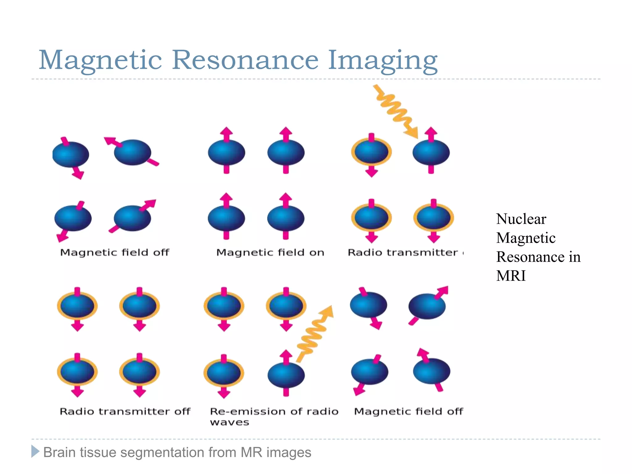 Brain tissue segmentation from MR images | PPT