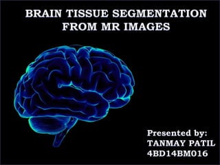 Brain tissue segmentation from MR images | PPT