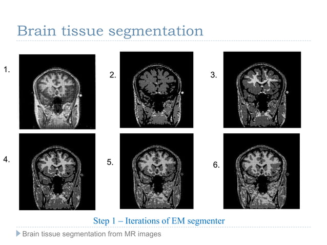 Brain tissue segmentation from MR images | PPT