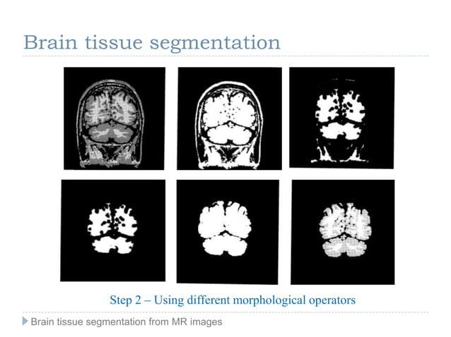 Brain tissue segmentation from MR images | PPT
