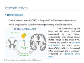 Brain tissue segmentation from MR images | PPT