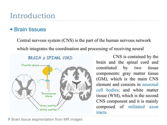 Brain tissue segmentation from MR images | PPT