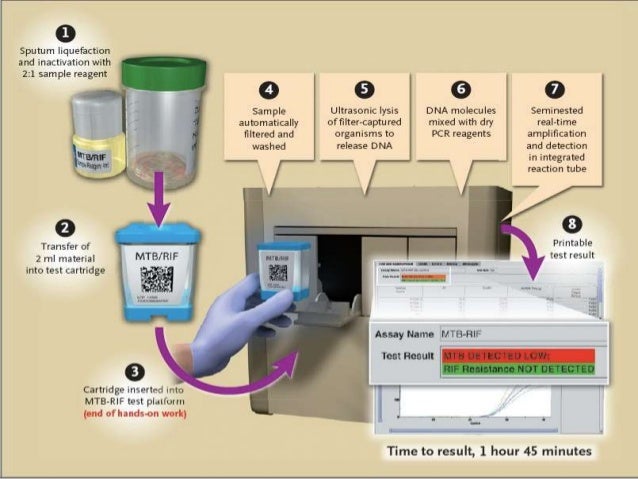 Recent advances in diagnosis of Tuberculosis – DR. TRYNAADH