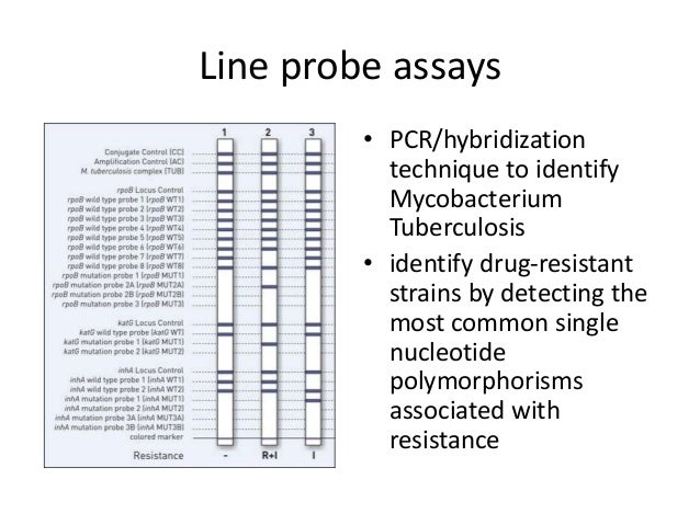Recent advances in diagnosis of Tuberculosis – DR. TRYNAADH