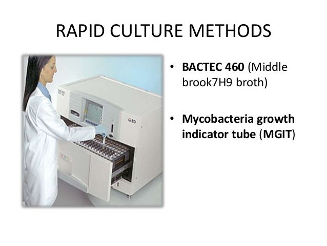 Recent advances in diagnosis of Tuberculosis – DR. TRYNAADH