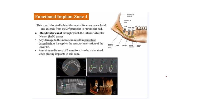 Radiographic imaging in implant drntistry | PPT