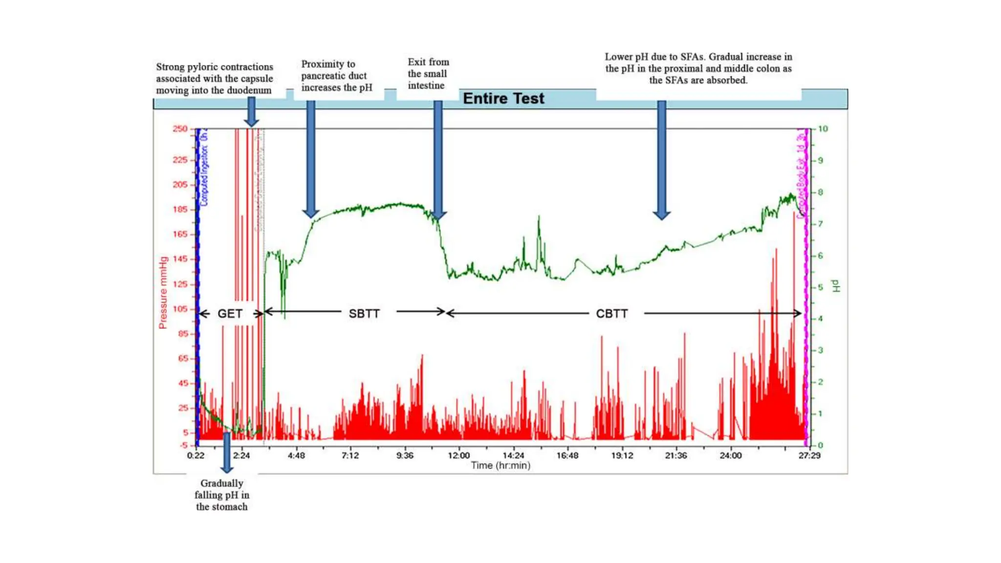seminar topic- chronic constipation.pptx