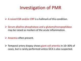 vasculitis | PPTX