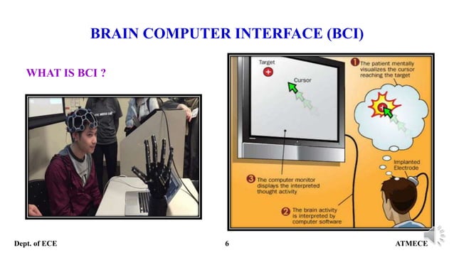 BRAIN CHIPS | PPT