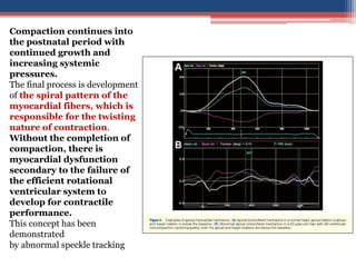 Noncompaction cardiomyopathy | PPTX